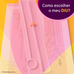 Como escolher o meu DIU? - Clínica Serpas