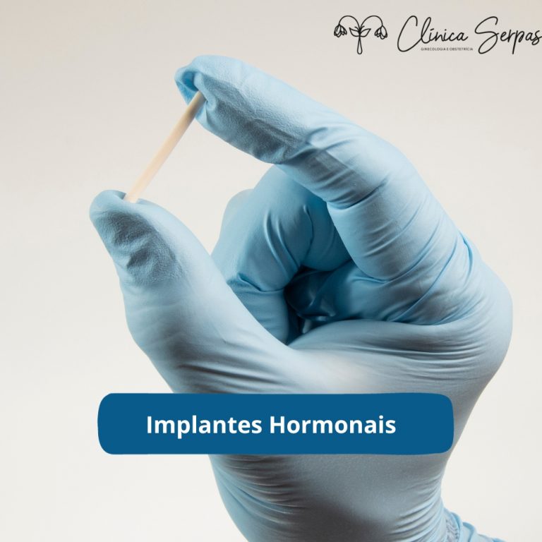 Implantes Hormonais: Tipos, Duração e Hormônios Principais - Clínica Serpas